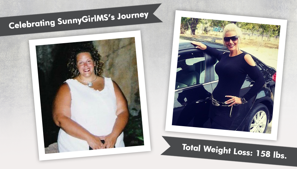 Before & After VSG with SunnyGirlMS - 158 Pounds Lost! : ObesityHelp