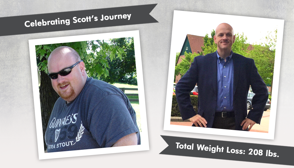 Before & After the Sleeve with Scott, losing 208lbs! : ObesityHelp