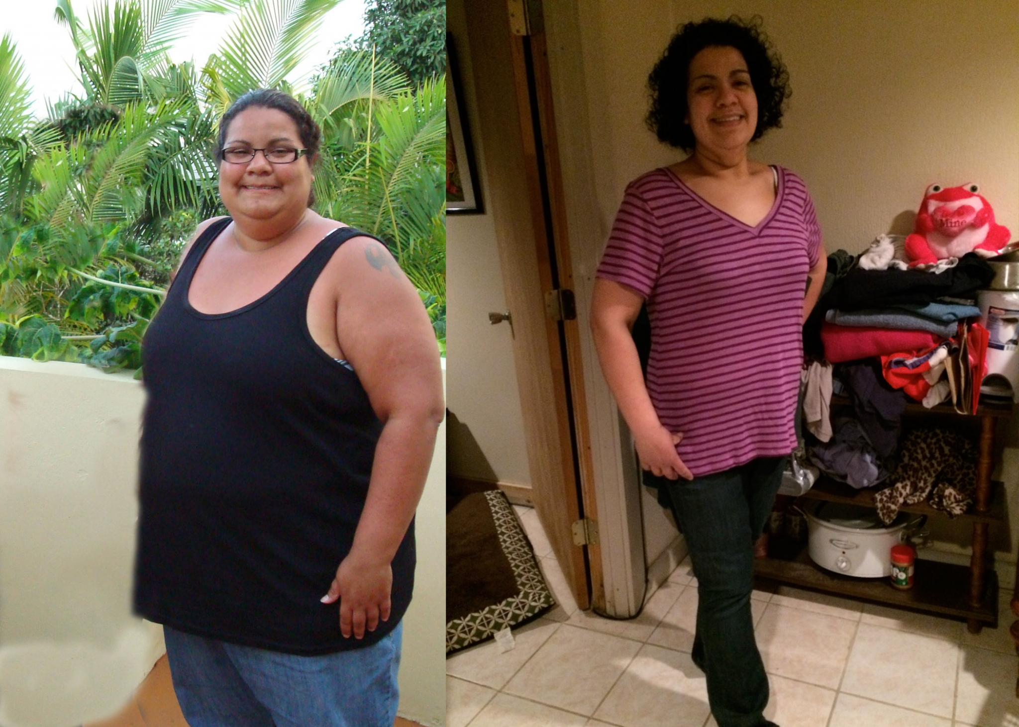 One Year Surgiversary! Down 148 lbs! PICS INCLUDED! :)