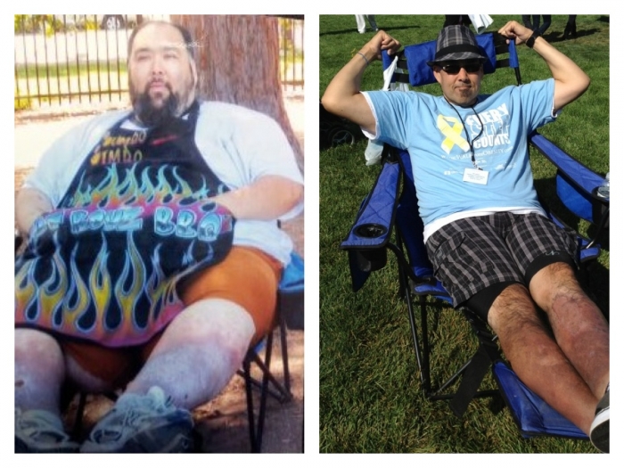 3 years out! 350lbs lost......before and now PIC