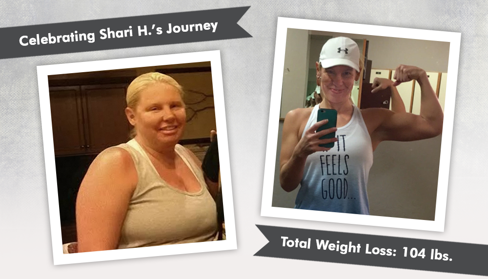 Before & After VSG with Shari H., losing 104 pounds! : ObesityHelp