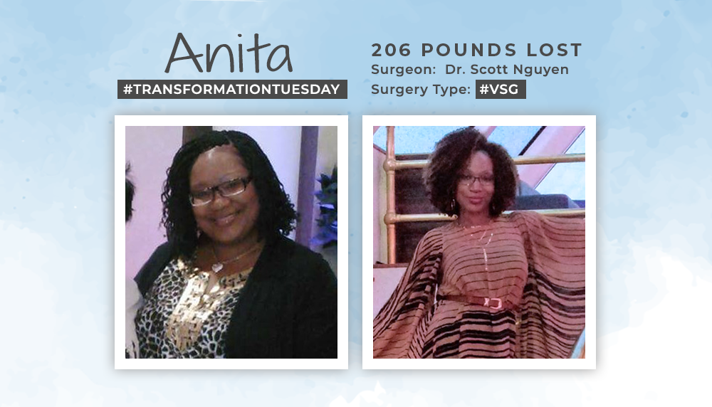 Before & After VSG with Anita, losing 206 pounds! : ObesityHelp