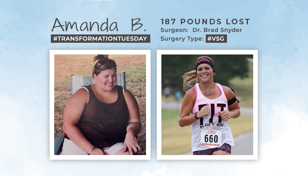 Before & After VSG with Amanda B., losing 187 pounds! : ObesityHelp