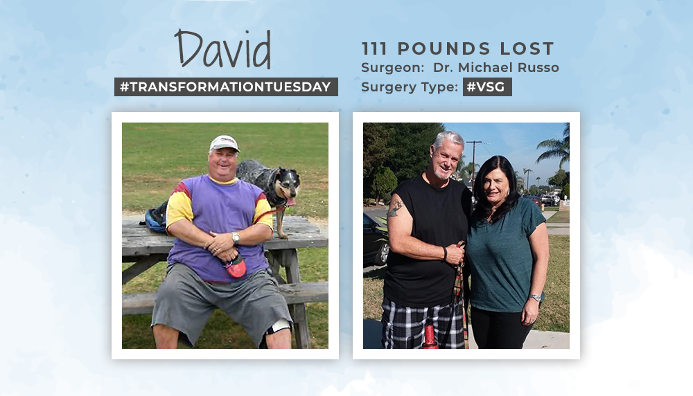 Before & After VSG with David, losing 111 pounds! : ObesityHelp