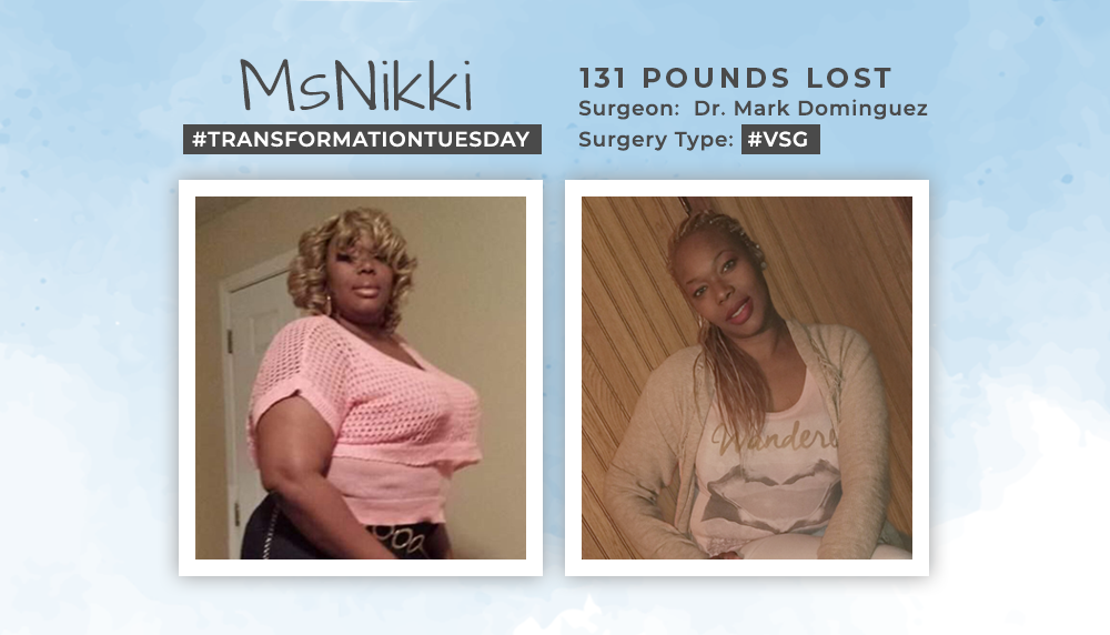 Before & After VSG of MsNikki, losing 131 pounds! : ObesityHelp