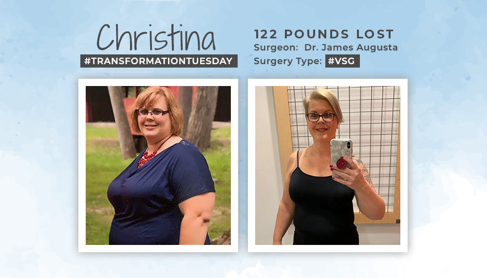 Before & After VSG with Christina, losing 122 pounds! : ObesityHelp