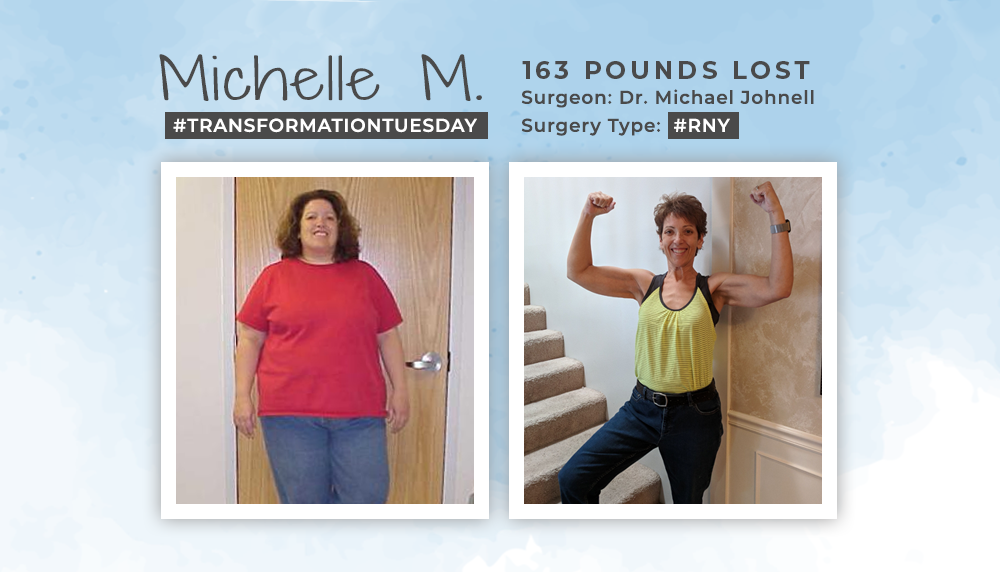 Before & After RNY with Michelle M., losing 163 pounds! : ObesityHelp
