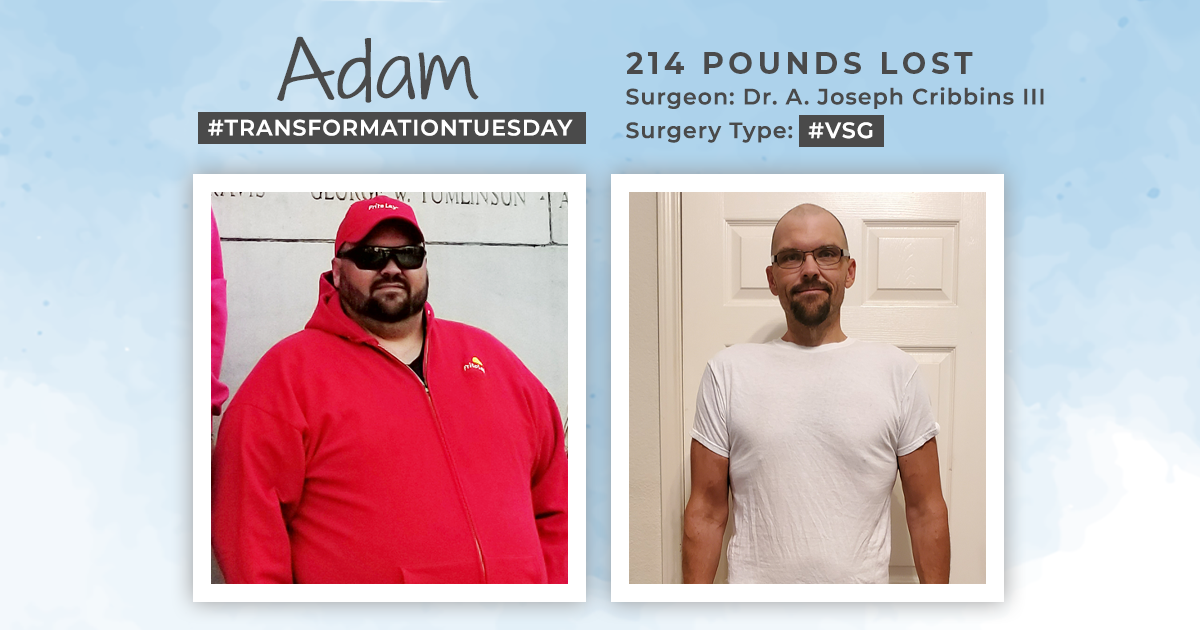 Before and After VSG with Adam, down 214 pounds! : ObesityHelp