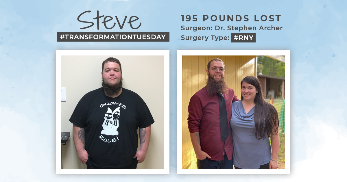 Before & After RNY with Steve, down 195 pounds! : ObesityHelp