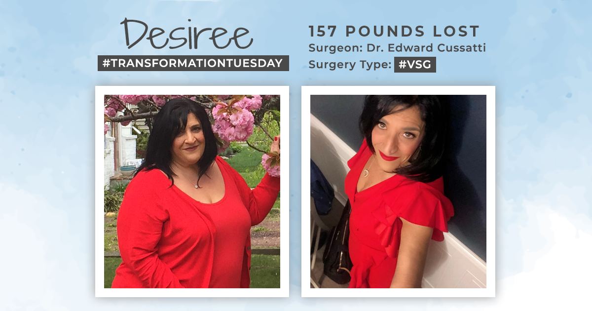 Before and After VSG with Desiree, down 157 pounds! : ObesityHelp