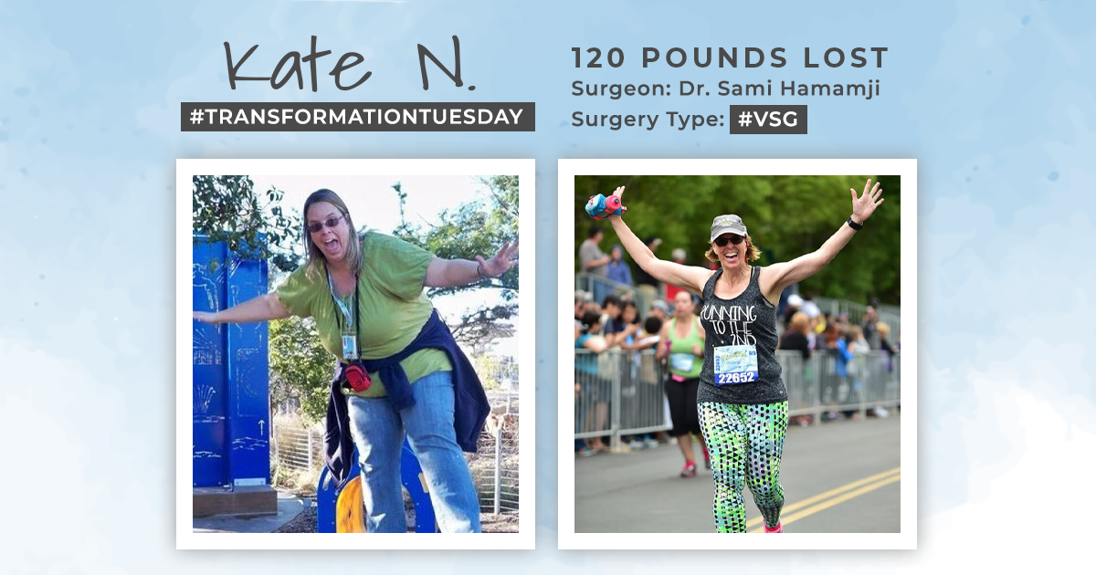 Before And After VSG With Kate N. Down 120 Pounds! : ObesityHelp